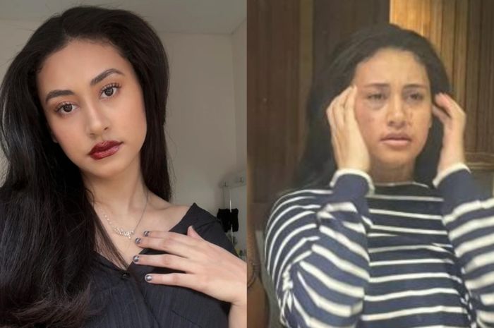 Afifah Riyad Diduga Alami KDRT hingga Wajah Babak Belur - Ntvnews.id