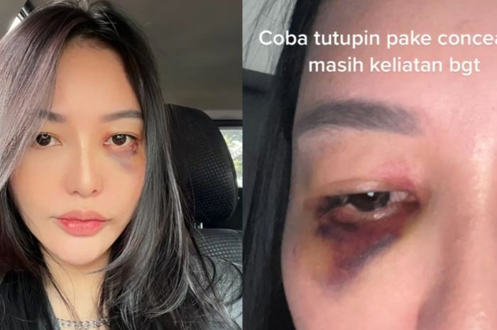 Bidi Jadi Korban KDRT Suami Usai Bongkar Perselingkuhan dengan LC - Ntvnews.id