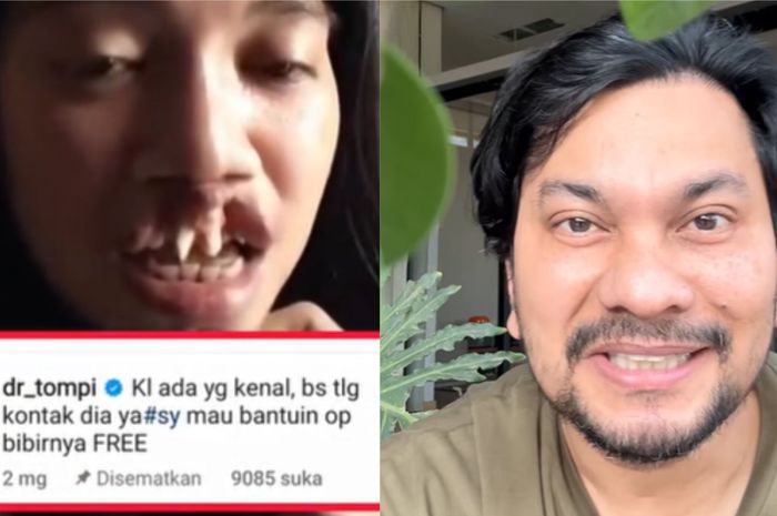 Dokter Tompi Bakal Kasih Operasi Plastik Gratis ke Rista Junianti yang ...